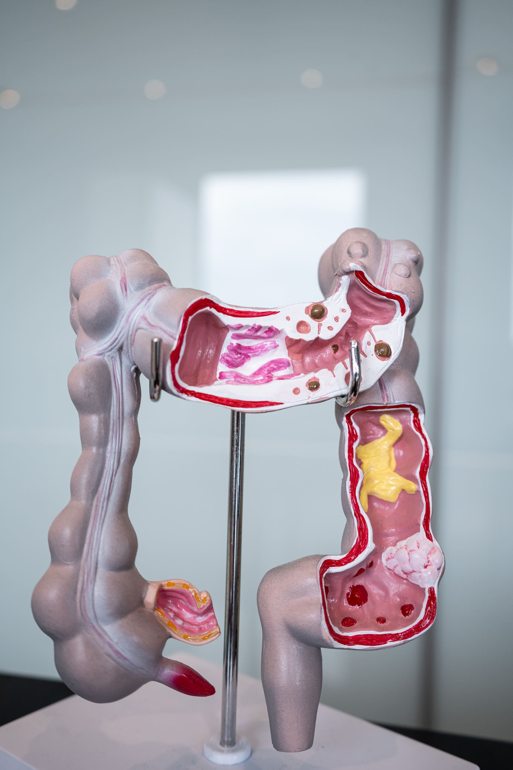 Proktologie Wien | Dr. Bernd Weiner